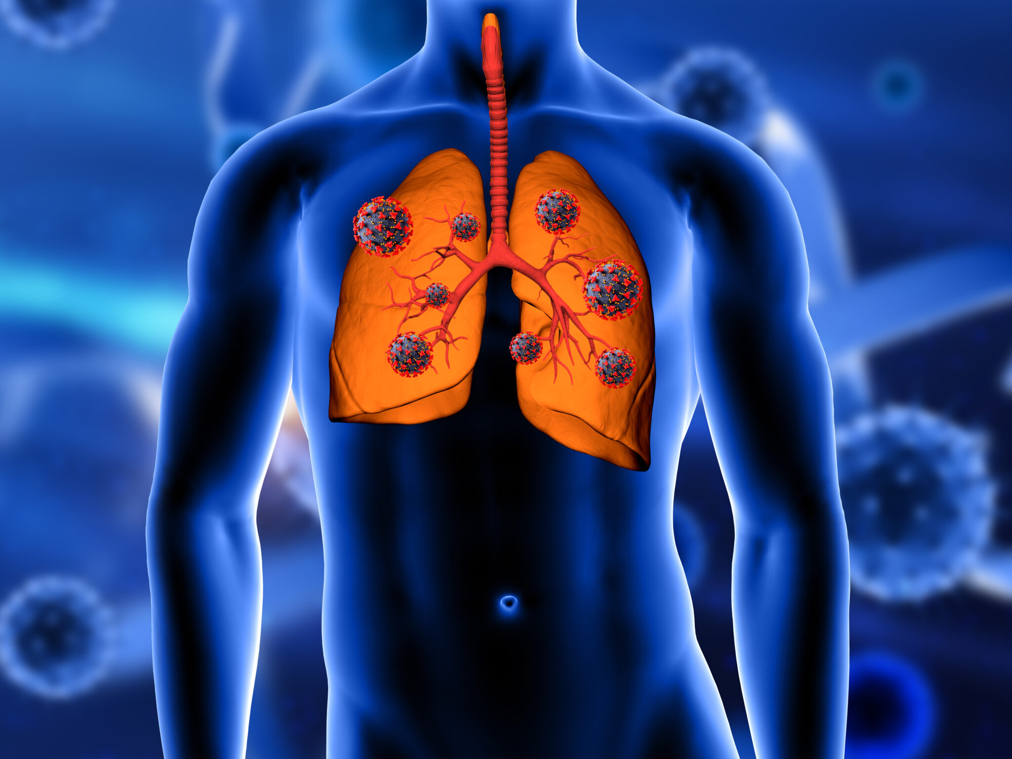 Pulmonary Care - elitecarehospitals
